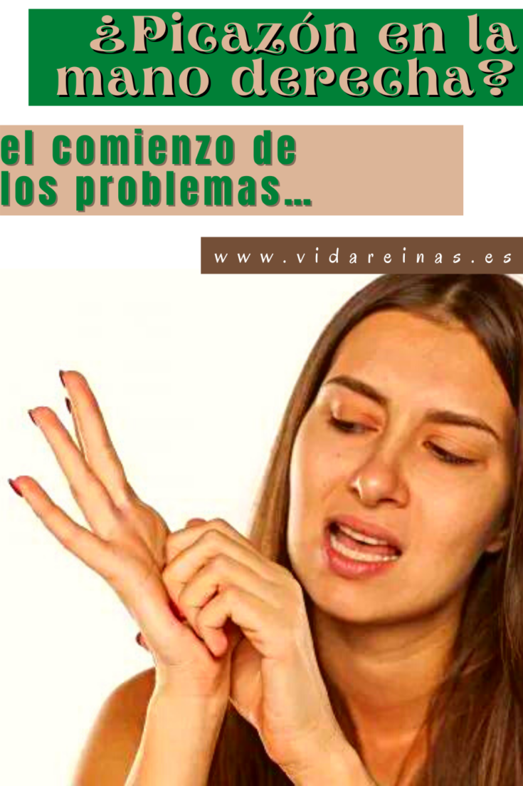 ¿Picazón en la mano derecha? El comienzo de los problemas... - Vida Reinas