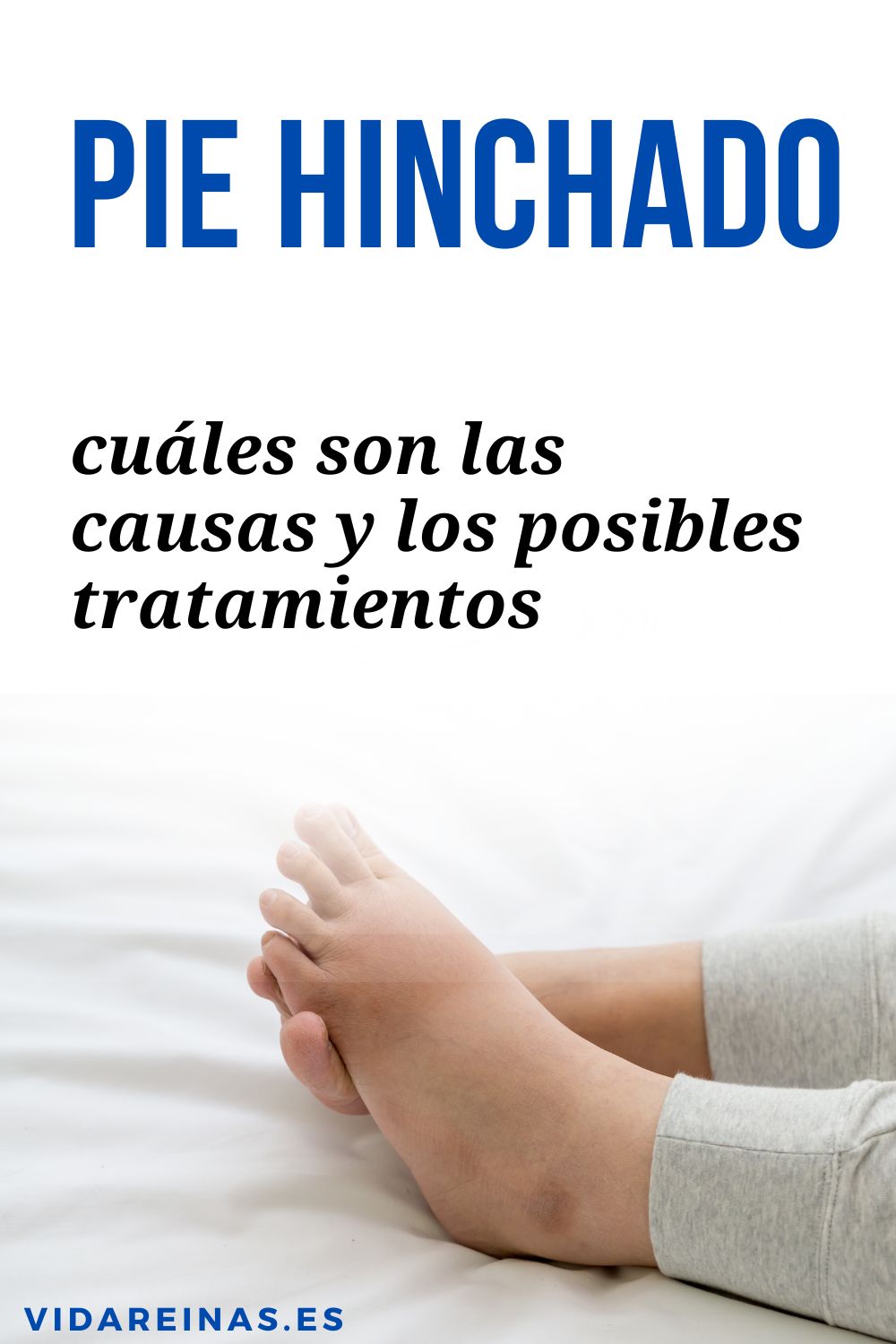 Pie hinchado: ¿cuáles son las causas y los posibles tratamientos ...